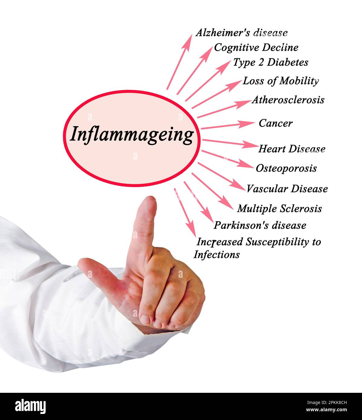 Inflammageing hi-res stock photography and images - Alamy