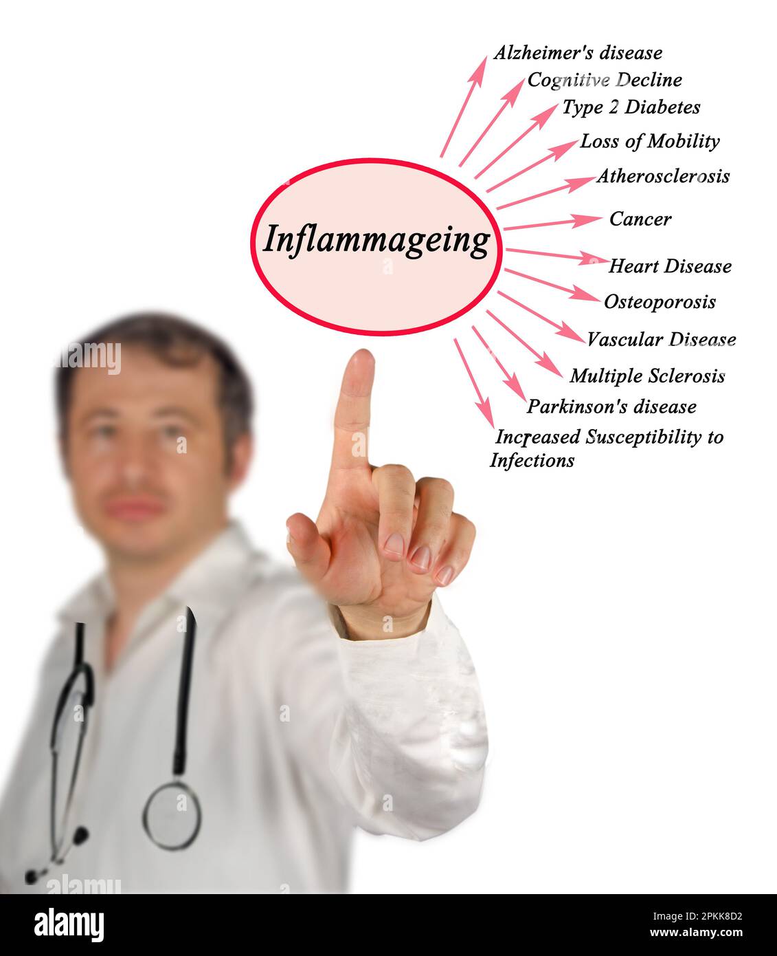 Inflammageing hi-res stock photography and images - Alamy