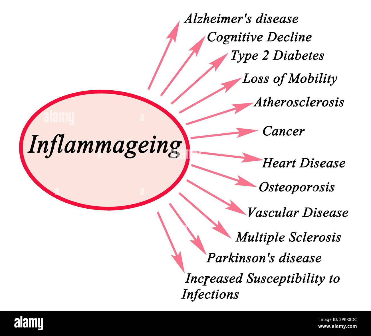 Inflammageing hi-res stock photography and images - Alamy