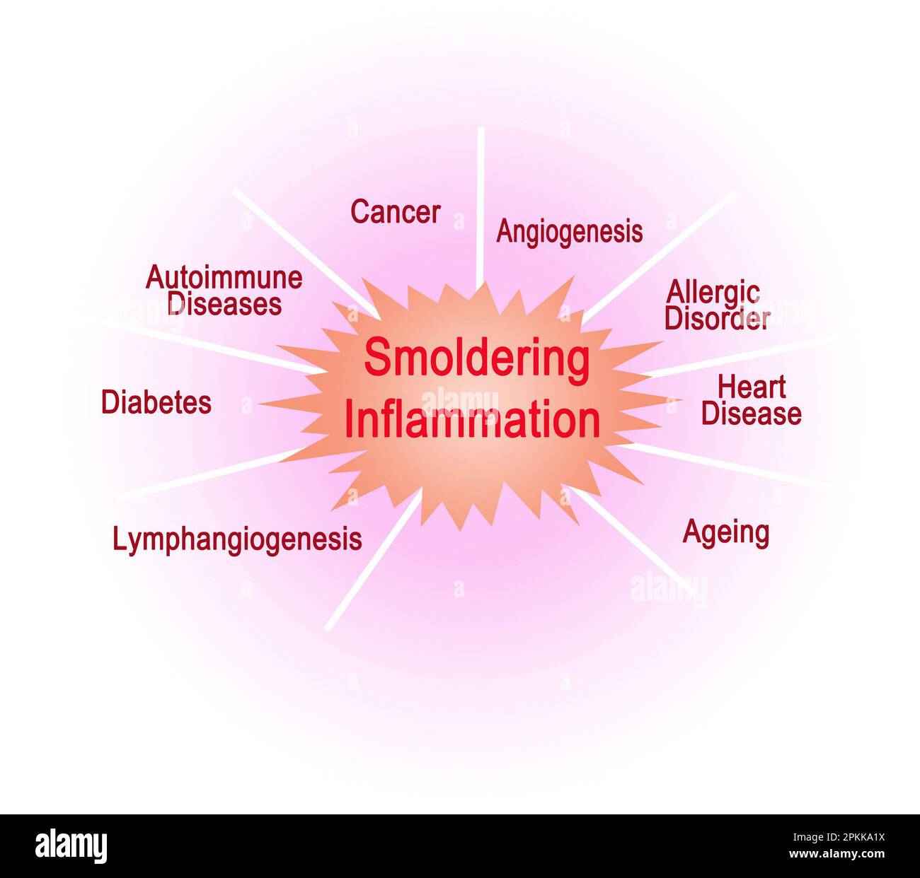 Consequences of Smoldering Inflammation Stock Photo - Alamy