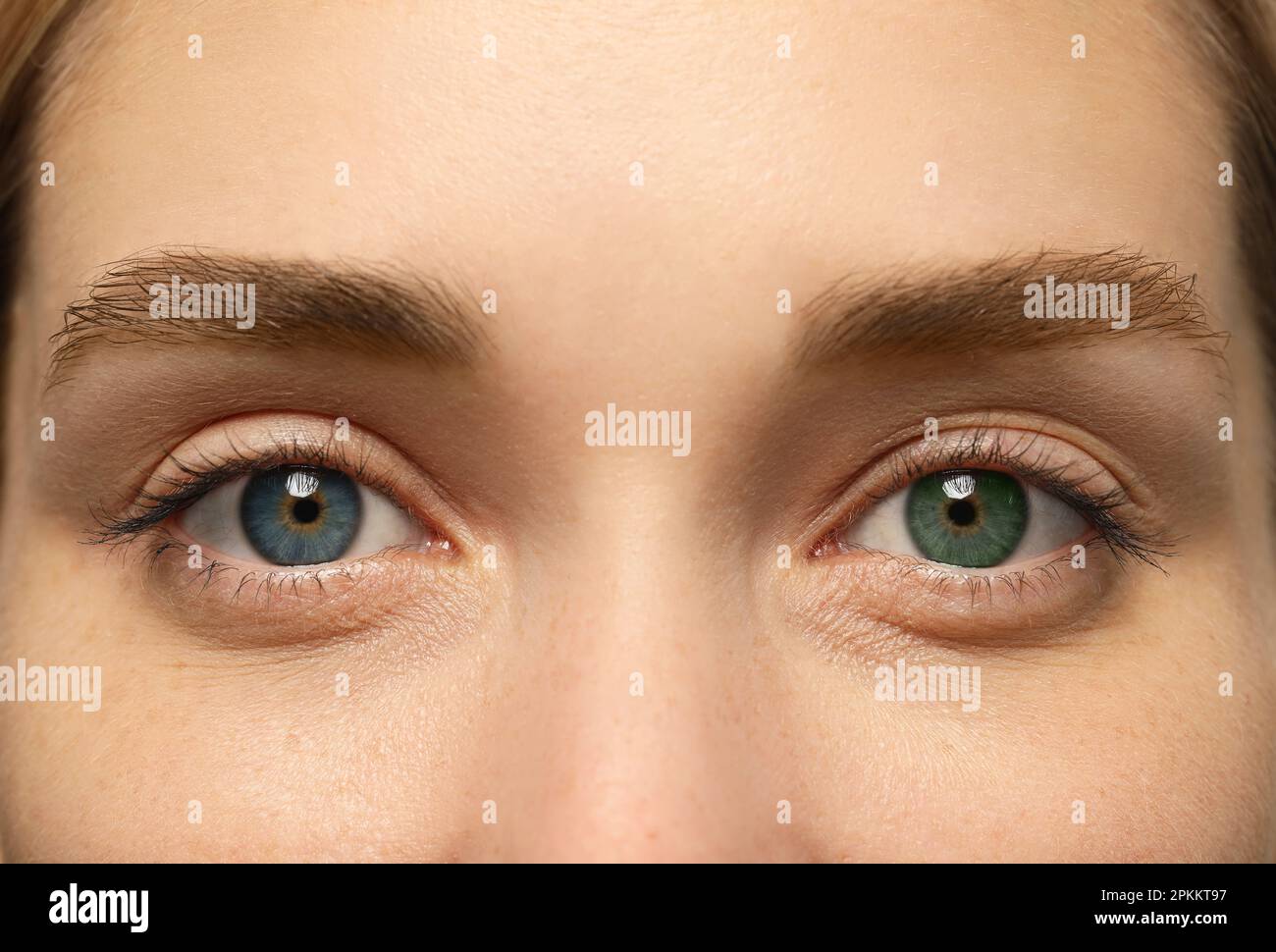 Woman with beautiful eyes of different colors, closeup. Heterochromia ...