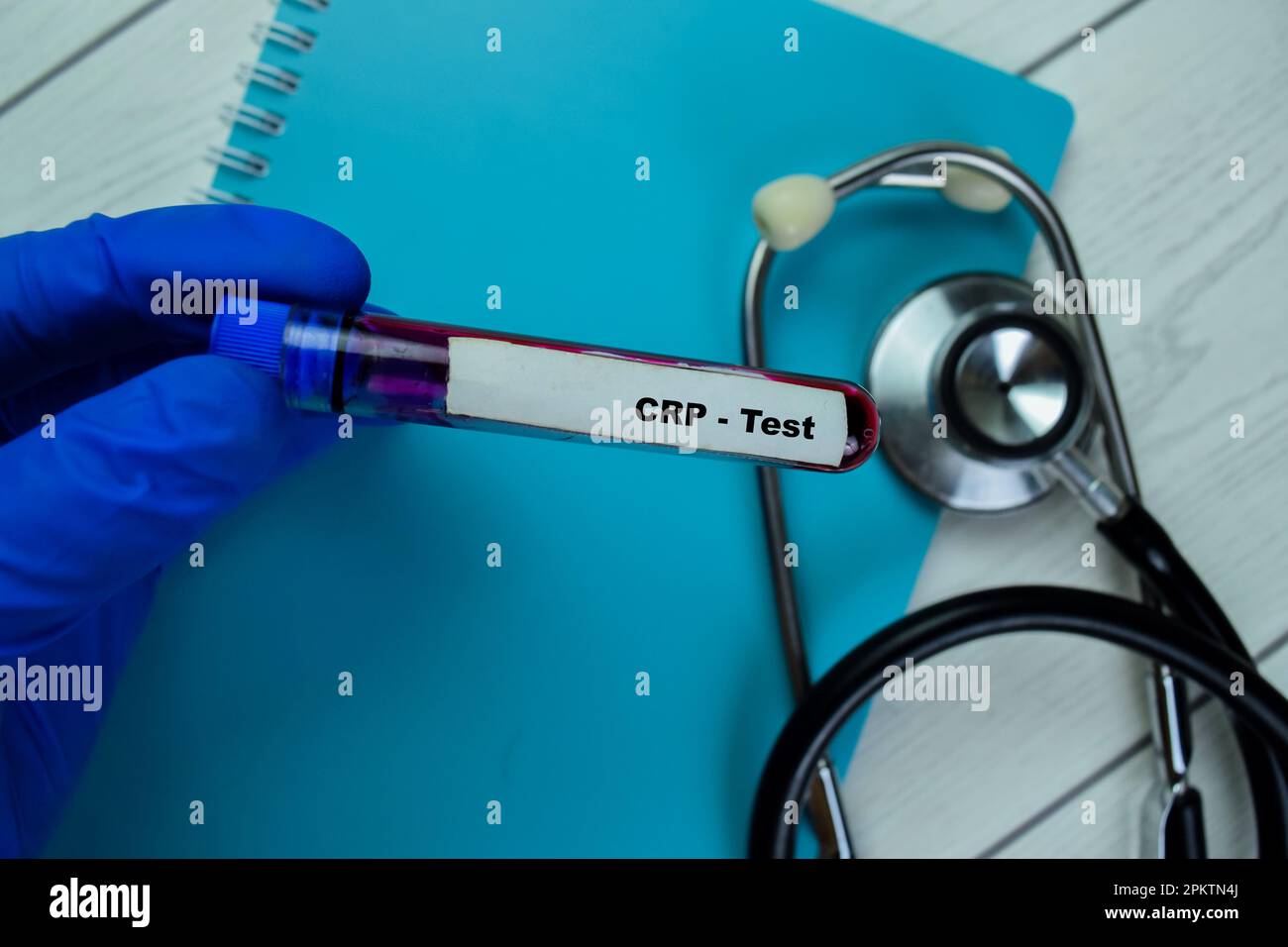 Concept of CRP - Test with blood sample. Healthcare or medical concept ...