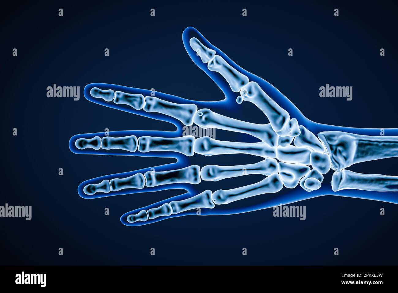 X Ray Hand Anatomy Images Of Hand And Wrist X Rays In Four Female