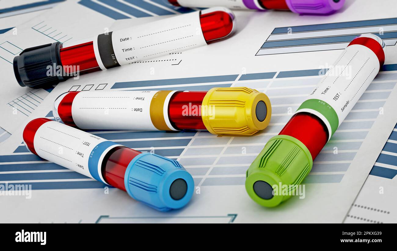 Blood vials with vibrant colored lids standing on medical forms. 3D ...