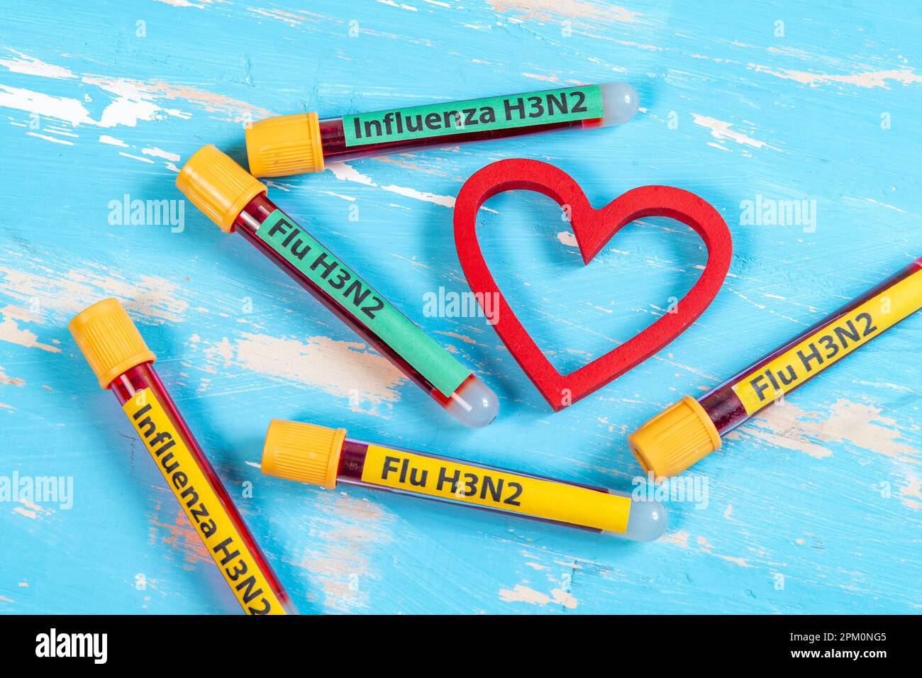 vacuum vials for blood collection written FLU H3N2 in reference to the ...