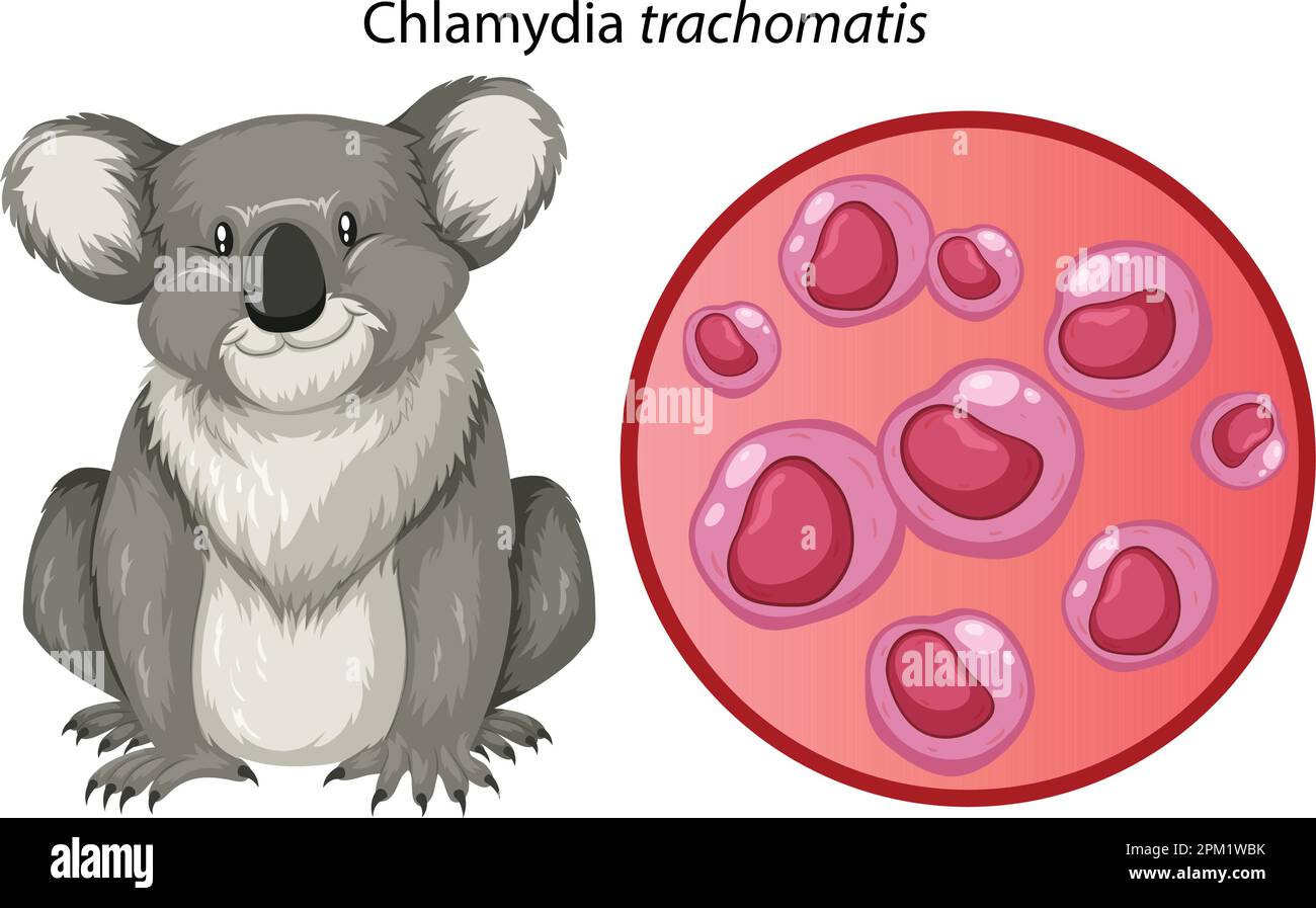 Chlamydia trachomatis with explanation illustration Stock Vector Image ...