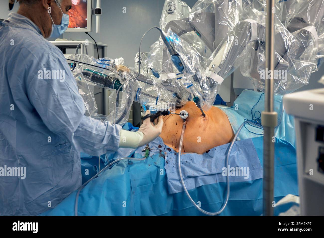 Surgical system with minimally invasive robot in a hospital. Robotic ...
