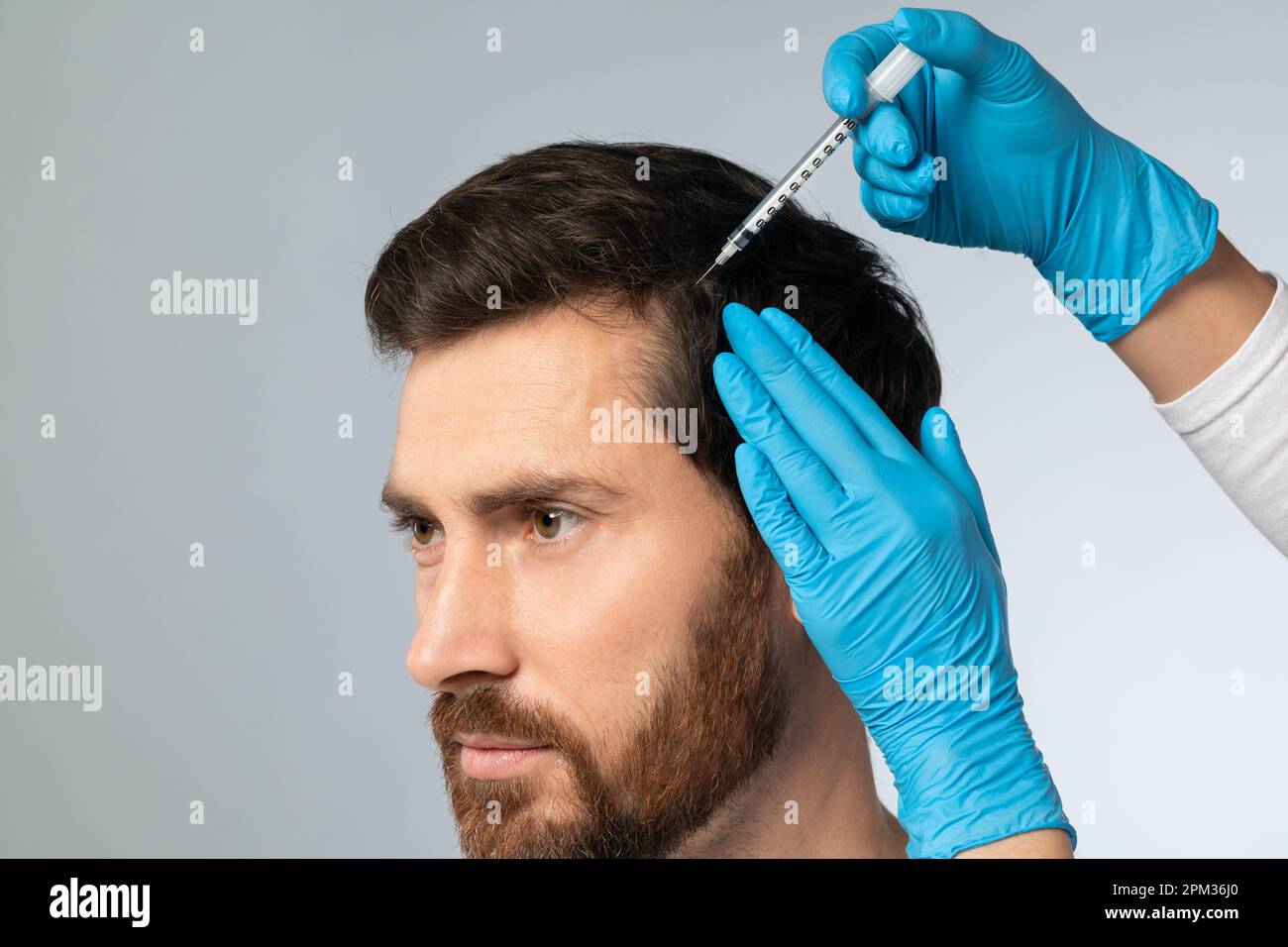 Mesotherapy for male hair. Handsome man receiving injections in his ...