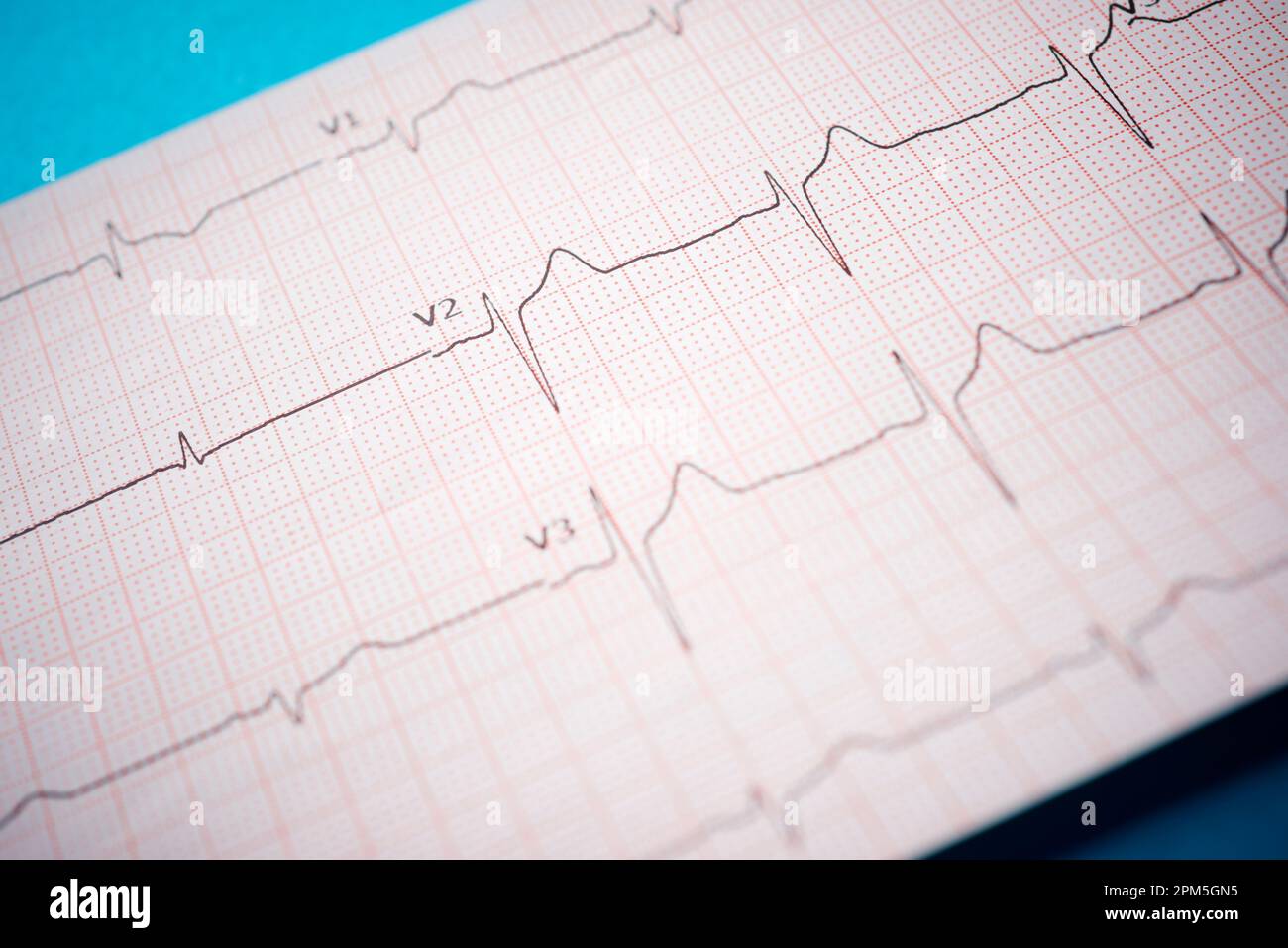 Ekg electrocardiogram blue hi-res stock photography and images - Alamy