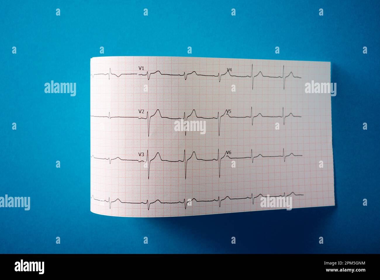 Electrocardiogram ecg hi-res stock photography and images - Alamy