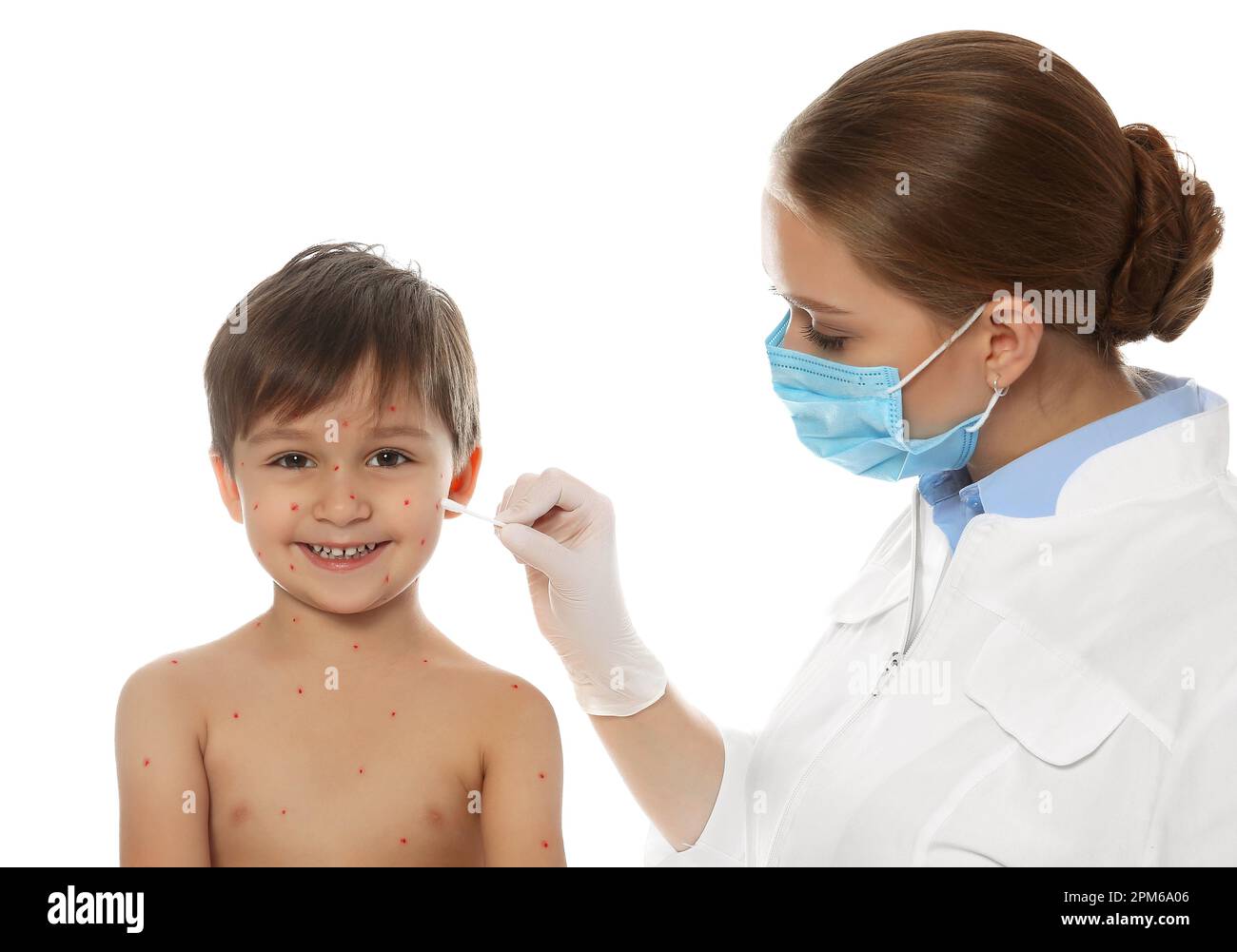 Doctor applying cream onto skin of little boy with chickenpox against ...