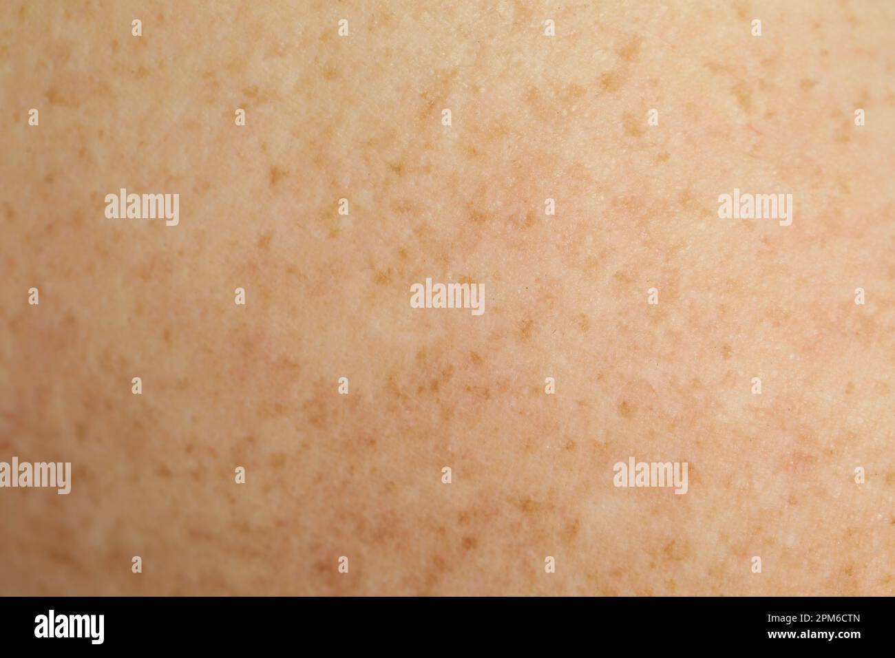 Texture of human skin as background, closeup view Stock Photo - Alamy