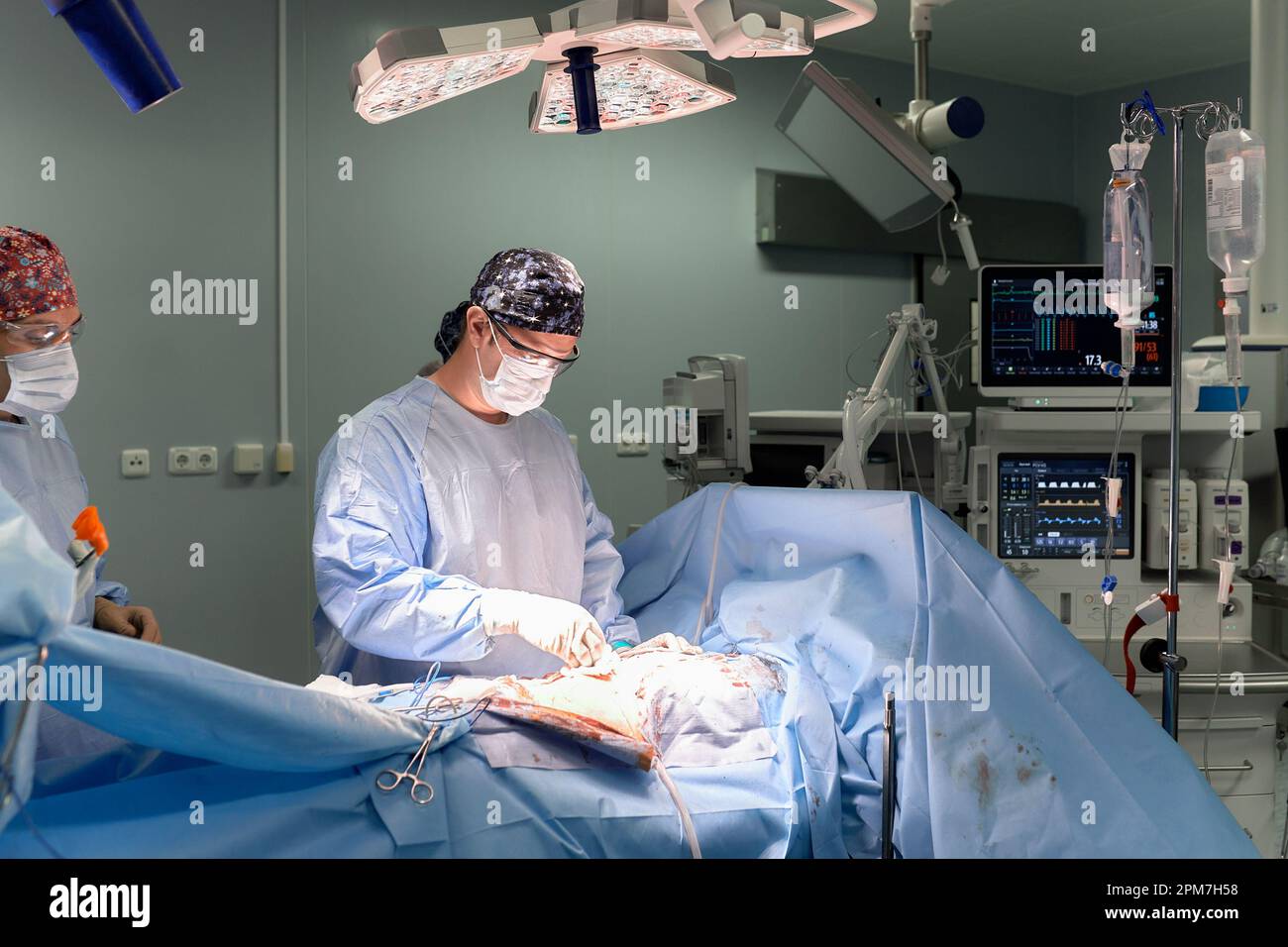 The faces of doctors surgeons in masks are a big plan, an operating ...