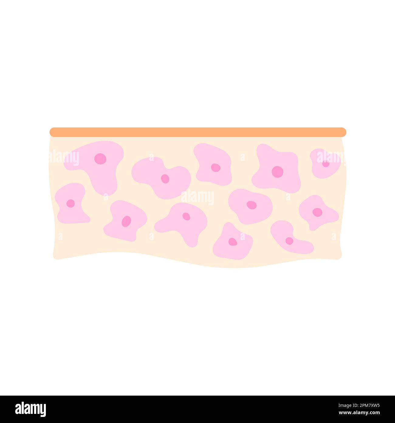 Skin cancer cell Stock Vector Images - Alamy