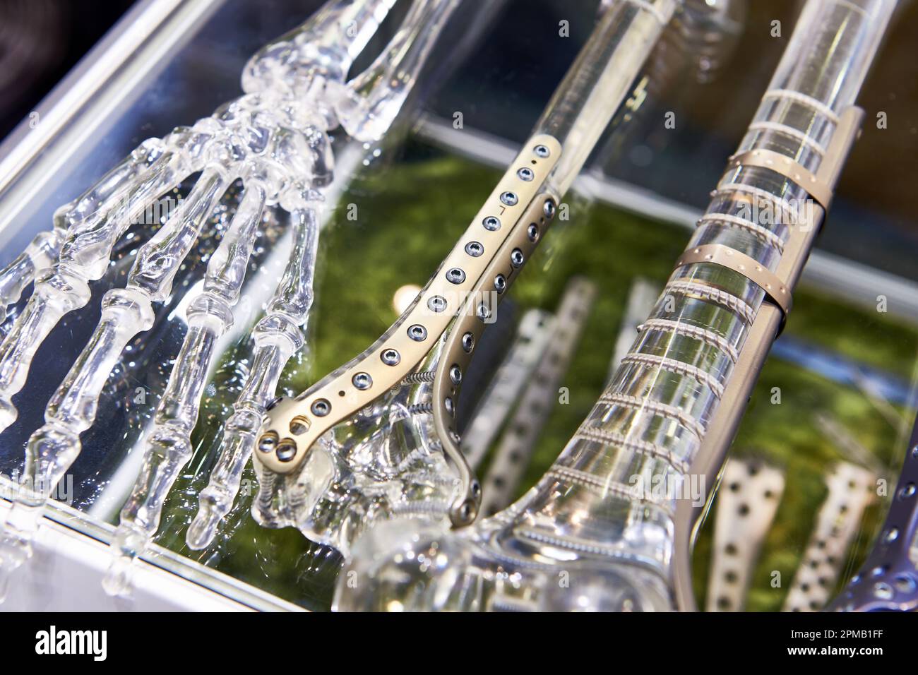 Human skeleton arm bones model hi-res stock photography and images - Alamy