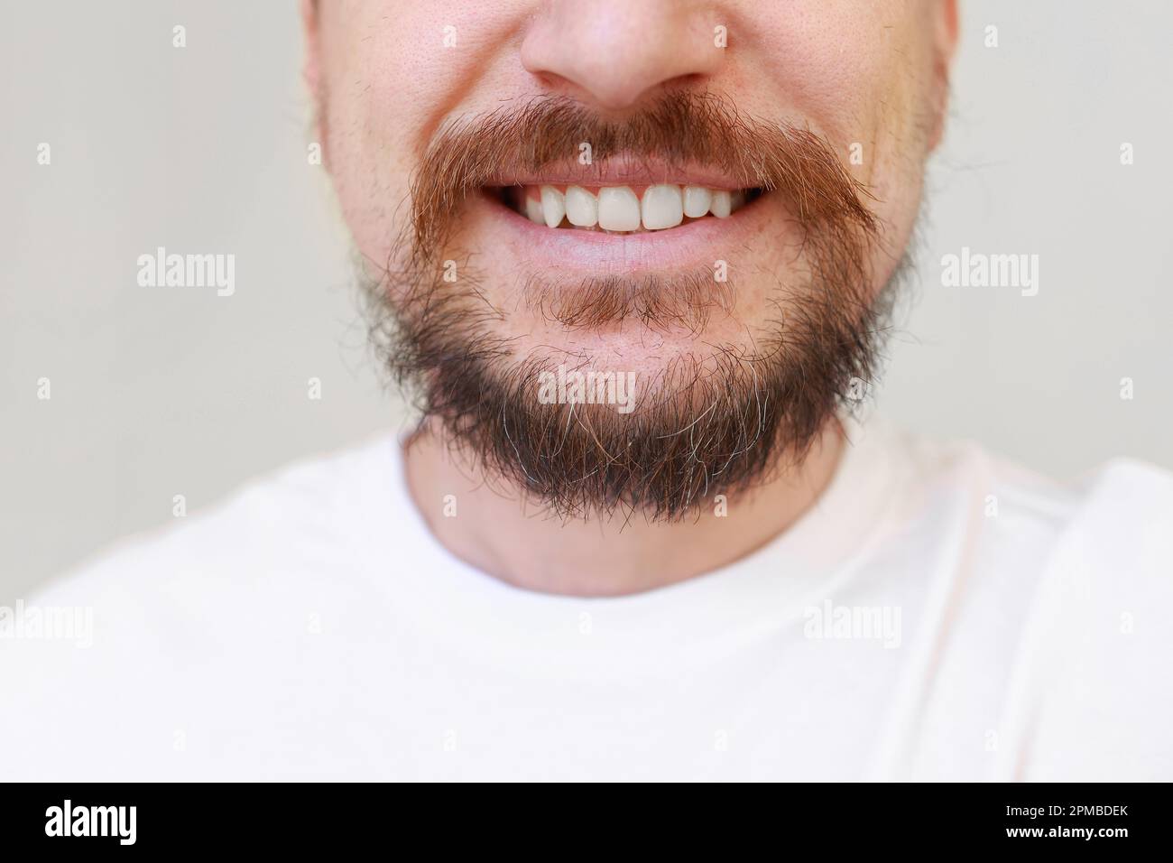 Cropped photo of bearded man first gray hairs on overgrown shaggy beard ...