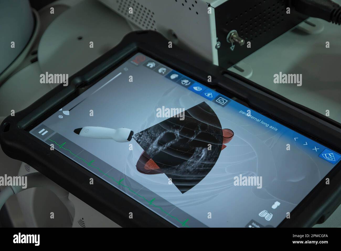 Screen of the ultrasound diagnostic machine. Leading American ...