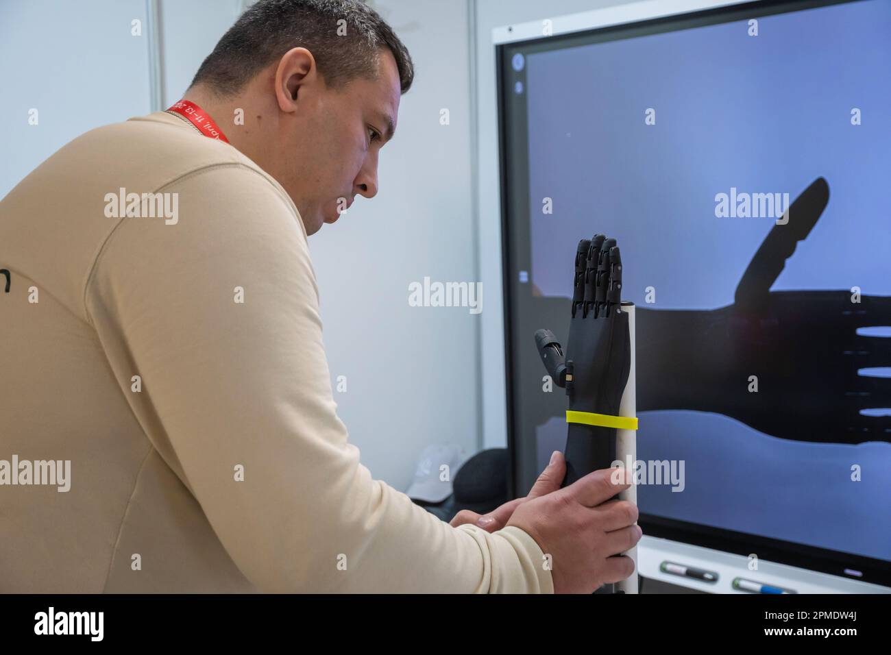 A man holds a bionic prosthetic hand at an exhibition of the latest ...
