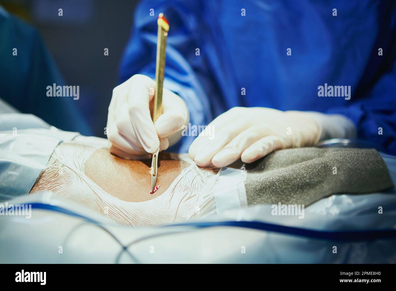 Making the perfect incision. a surgeon in an operating room Stock Photo ...