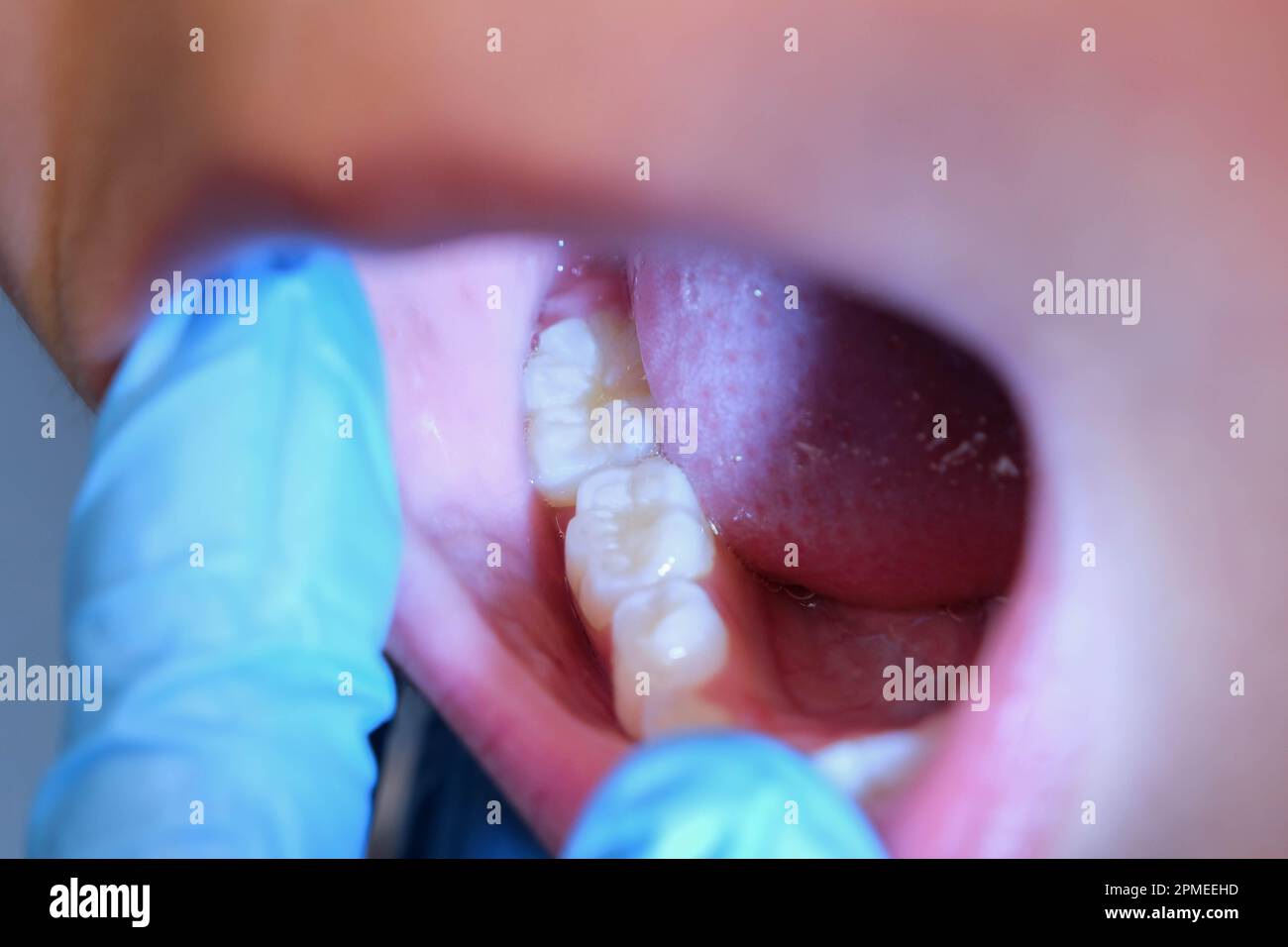 Close-up inside the oral cavity of a healthy child with beautiful rows ...