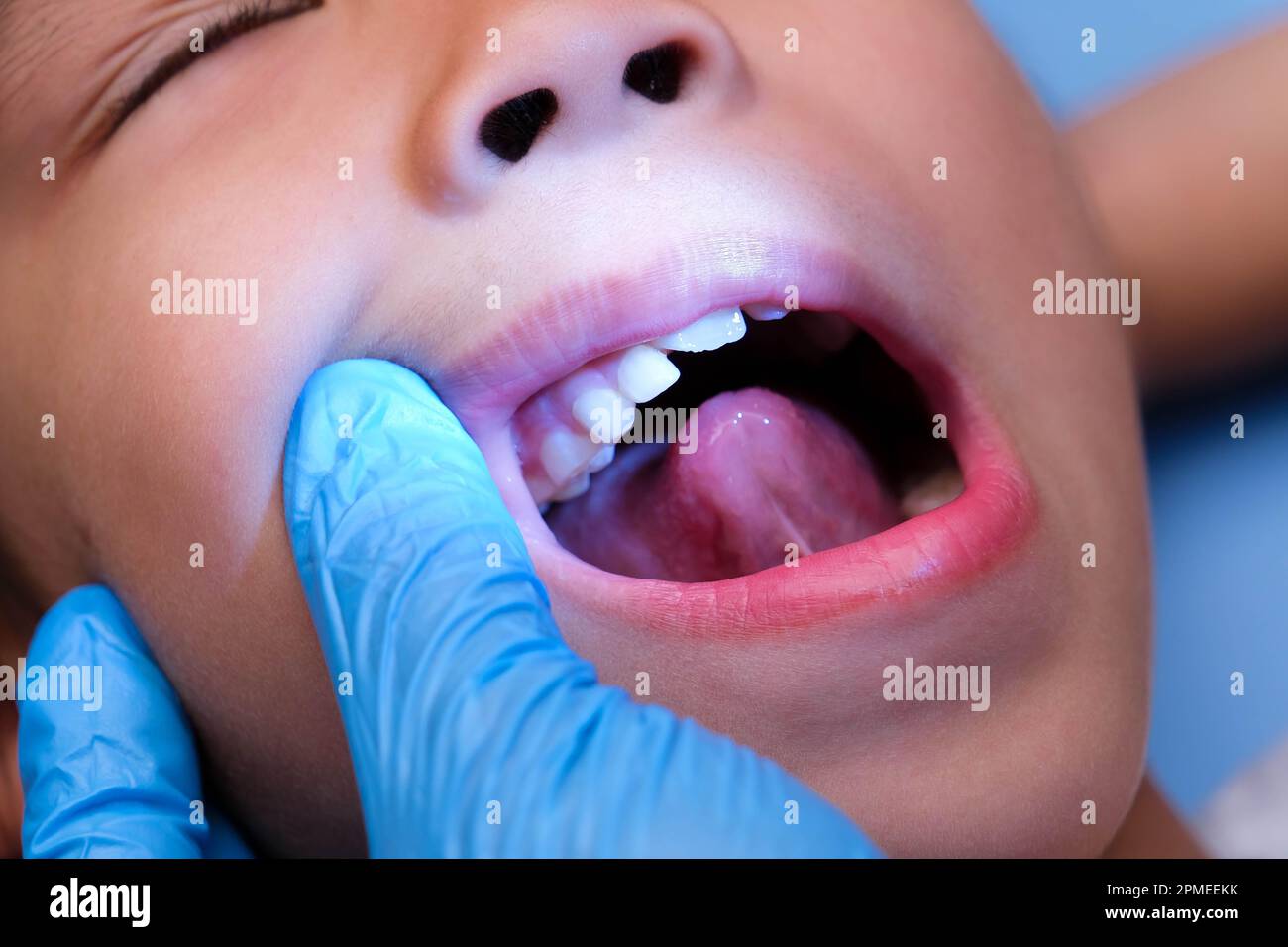 Close-up inside the oral cavity of a healthy child with beautiful rows ...