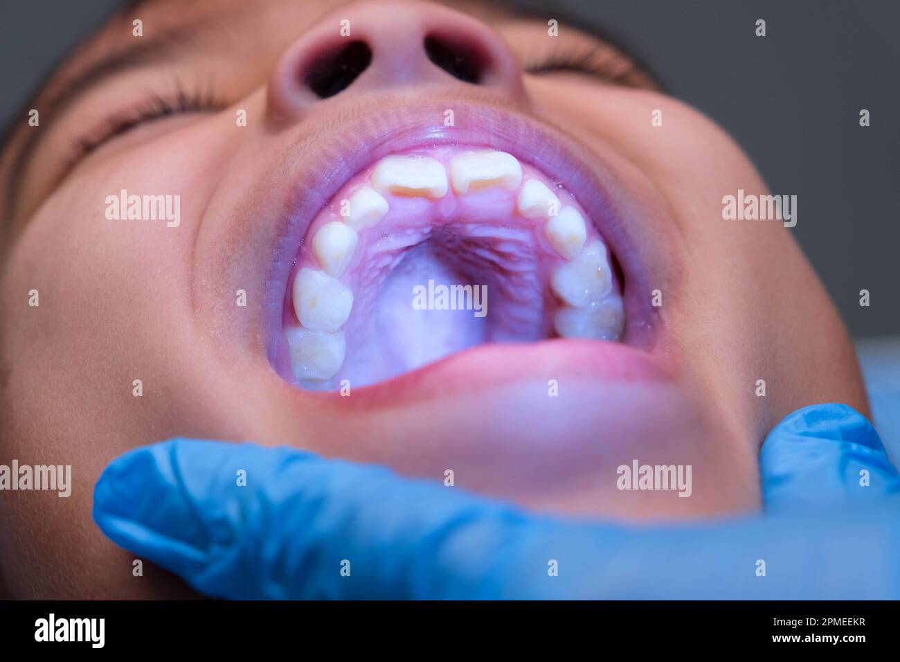Close-up inside the oral cavity of a healthy child with beautiful rows ...