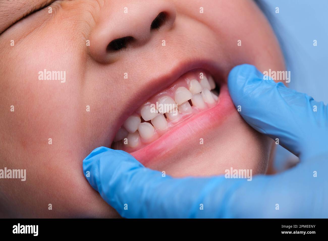 Close-up inside the oral cavity of a healthy child with beautiful rows ...