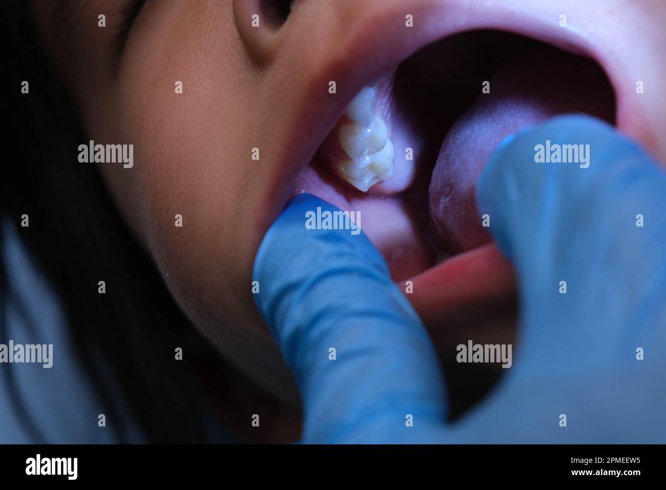 Close-up inside the oral cavity of a healthy child with beautiful rows ...