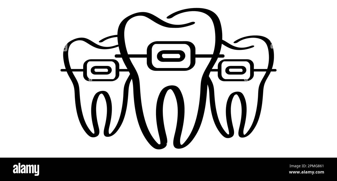 Orthodontic dental care bracket or brace. Teeth dentist, braces ...
