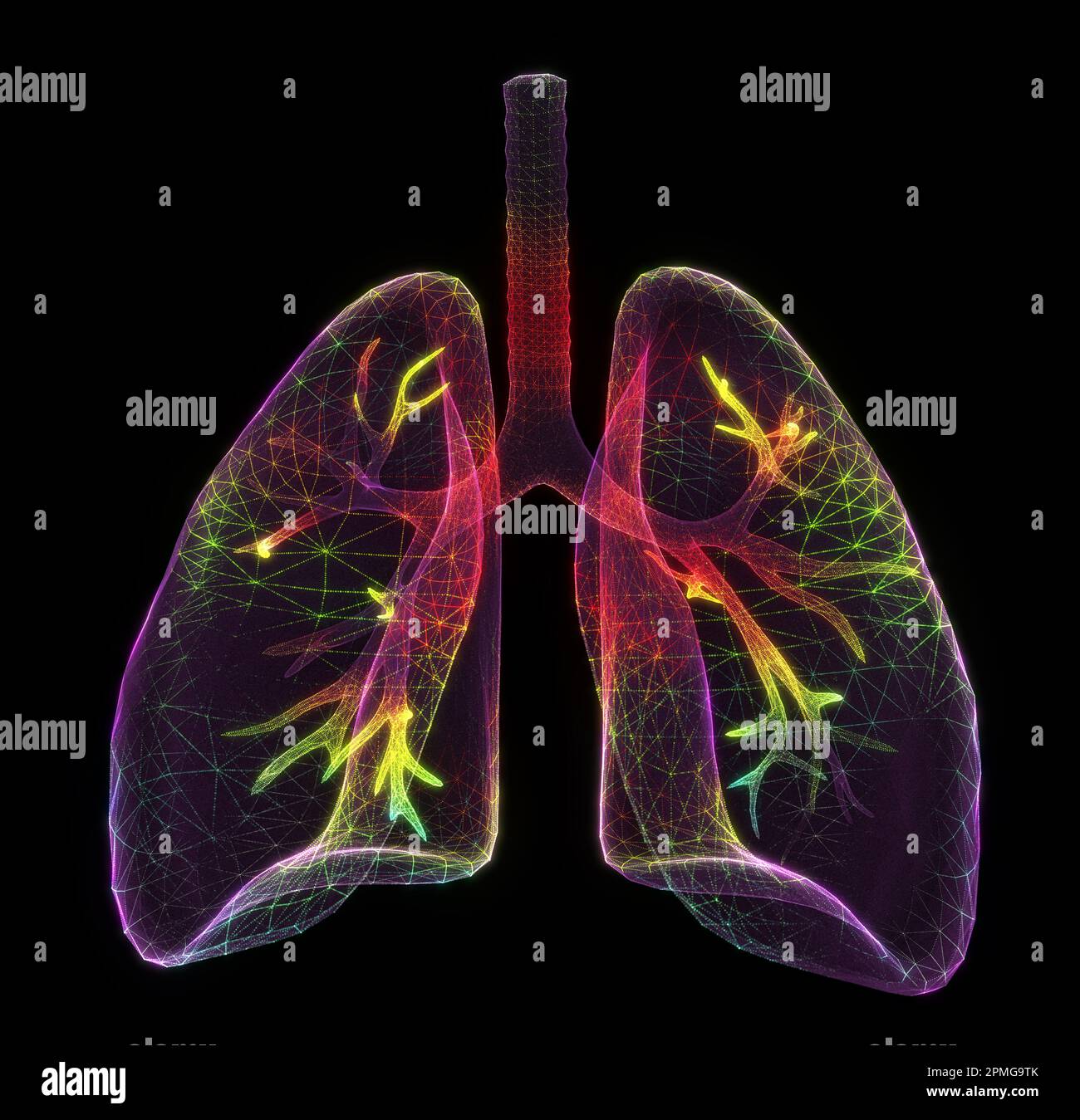 Human lungs. SARS disease, coronaviruses in the lungs. The coronavirus ...