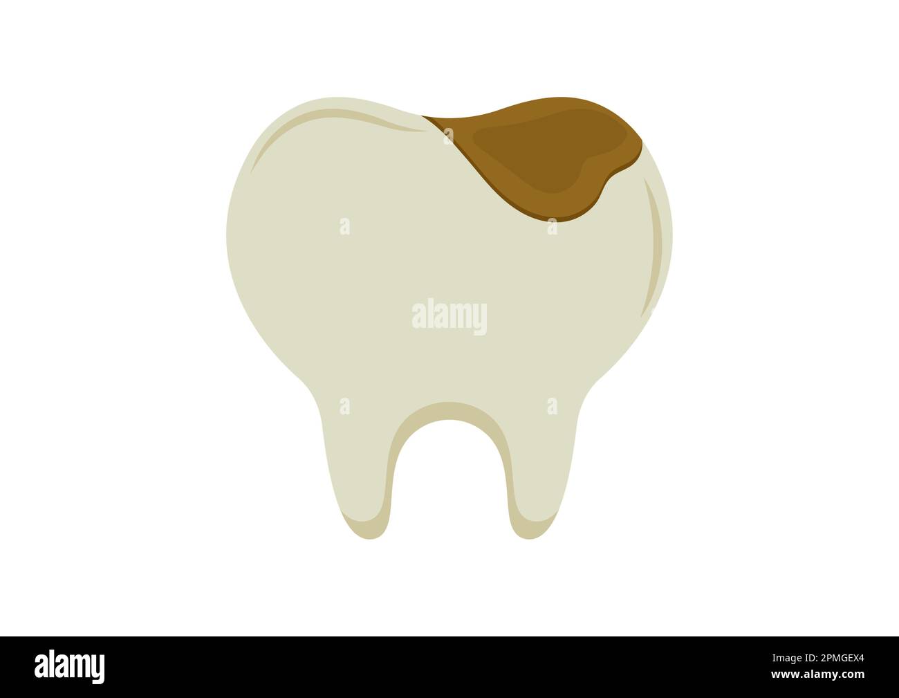 Decayed tooth vector illustration isolated on white background Stock ...