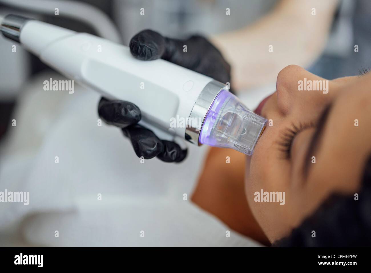 Microneedle RF lifting procedure. Hardware cosmetology. Beautician ...