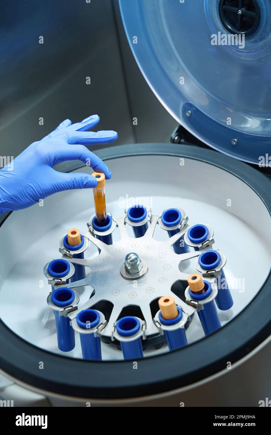 Top view of production of plasma from blood in a separator Stock Photo ...