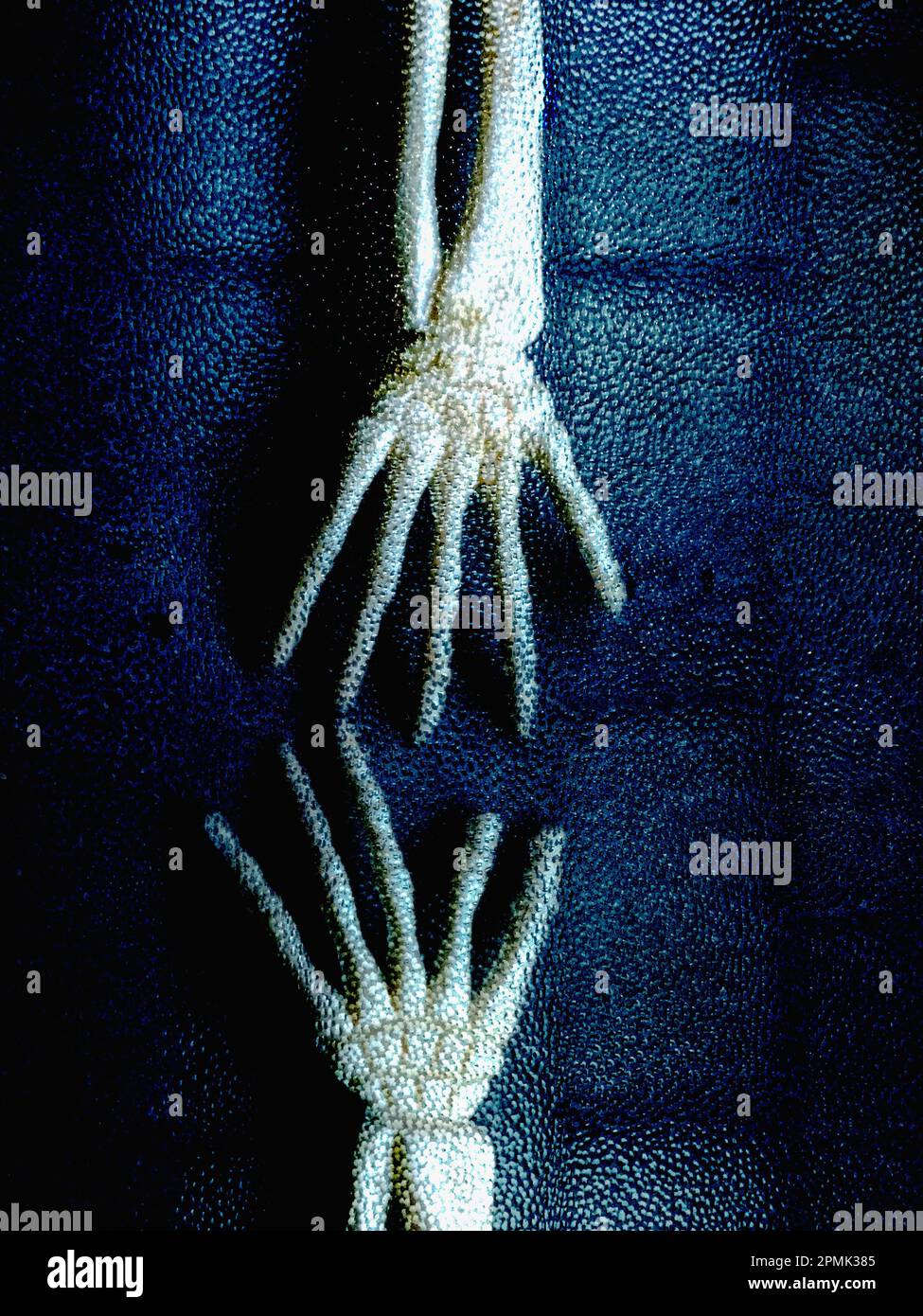 Two skeleton hands close to touching with one hand missing some bone on ...
