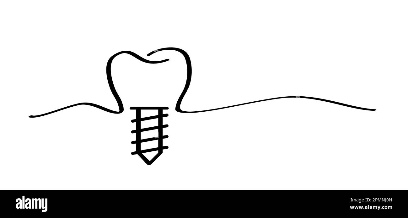 Dental implant, medically accurate or dental bridge. Cartoon healthy ...