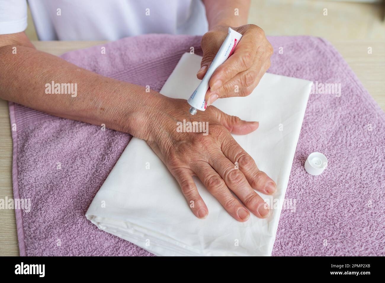 an elderly woman applies healing cream for arthritis on her old hands ...