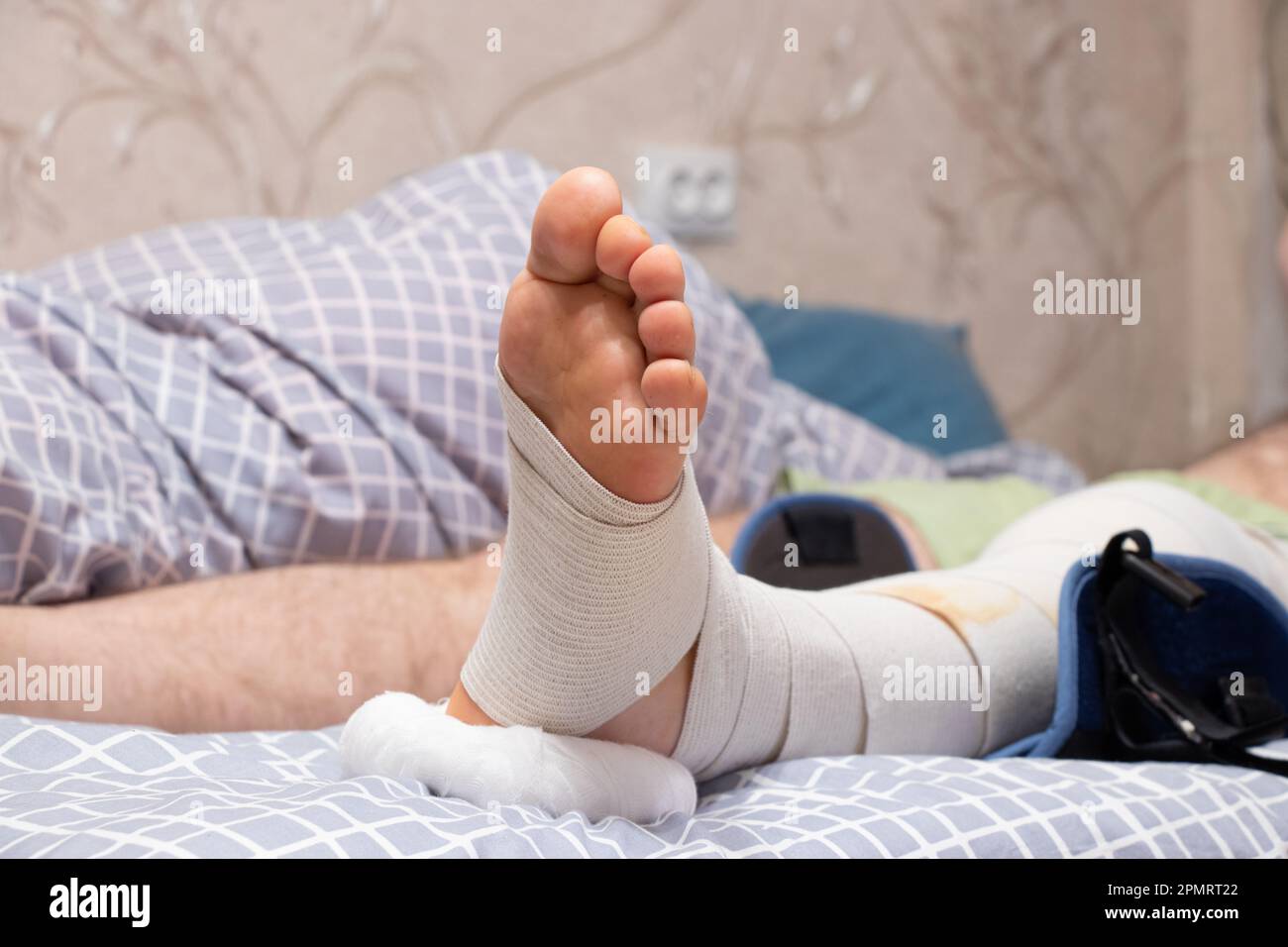 Man's leg with an elastic bandage and a knee orthosis after replacing ...