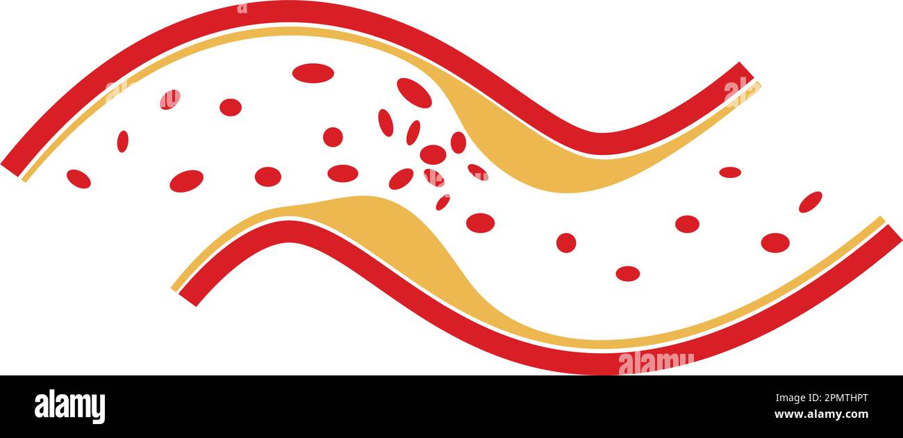 vector of cholesterol plaque illustratrion design Stock Vector Image ...