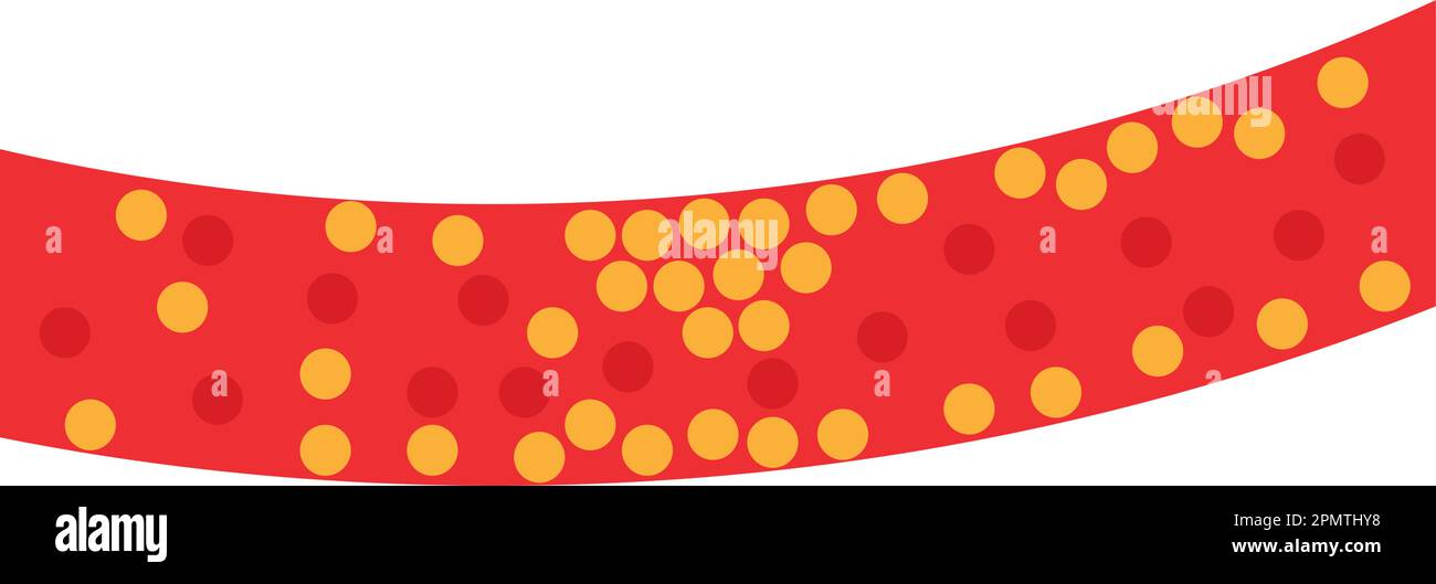 vector of cholesterol plaque illustratrion design Stock Vector Image ...