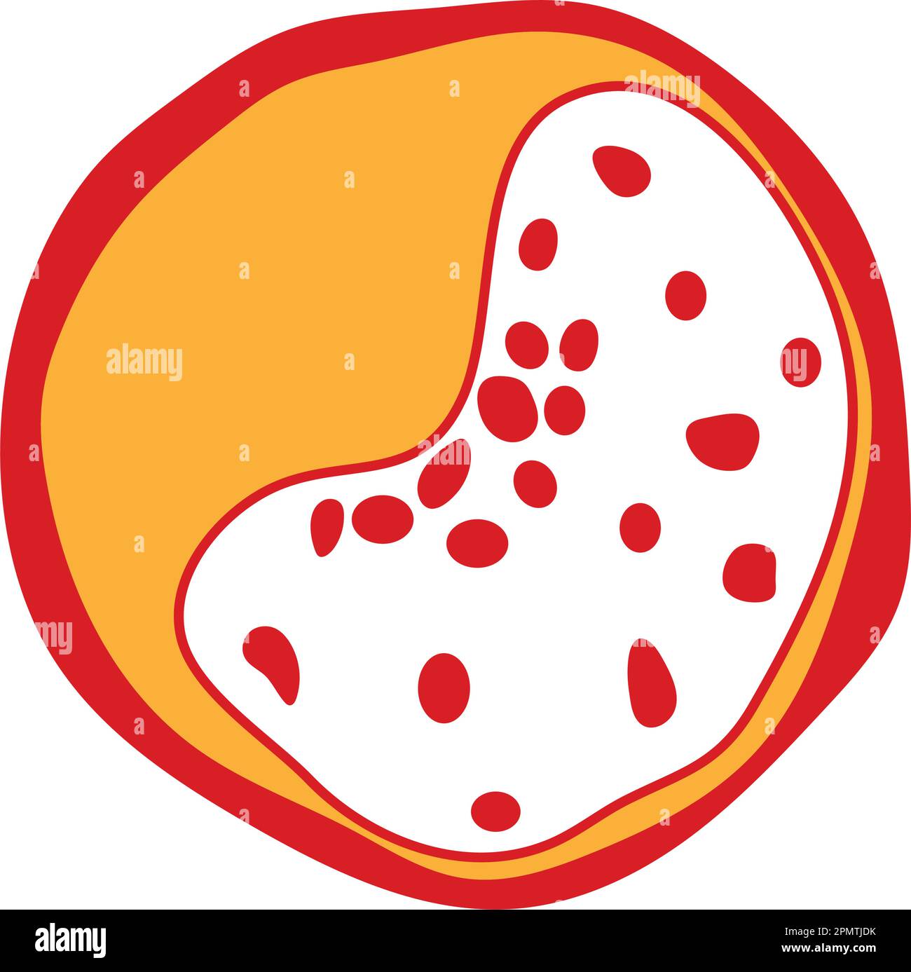 vector of cholesterol plaque illustratrion design Stock Vector Image ...