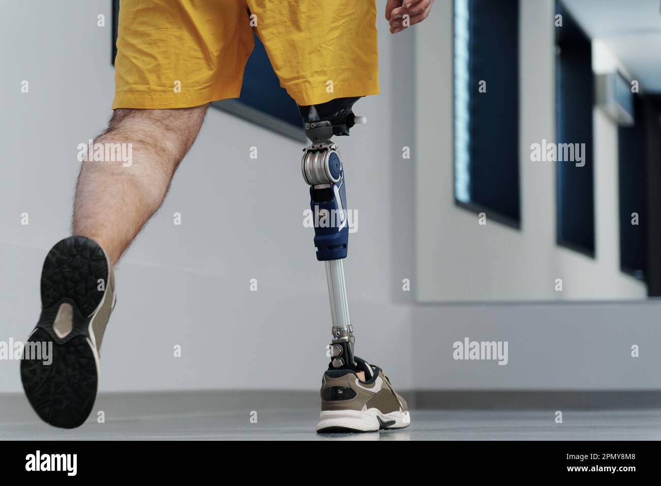 Unrecognisable male in yellow coloured shorts wearing prosthetic leg ...