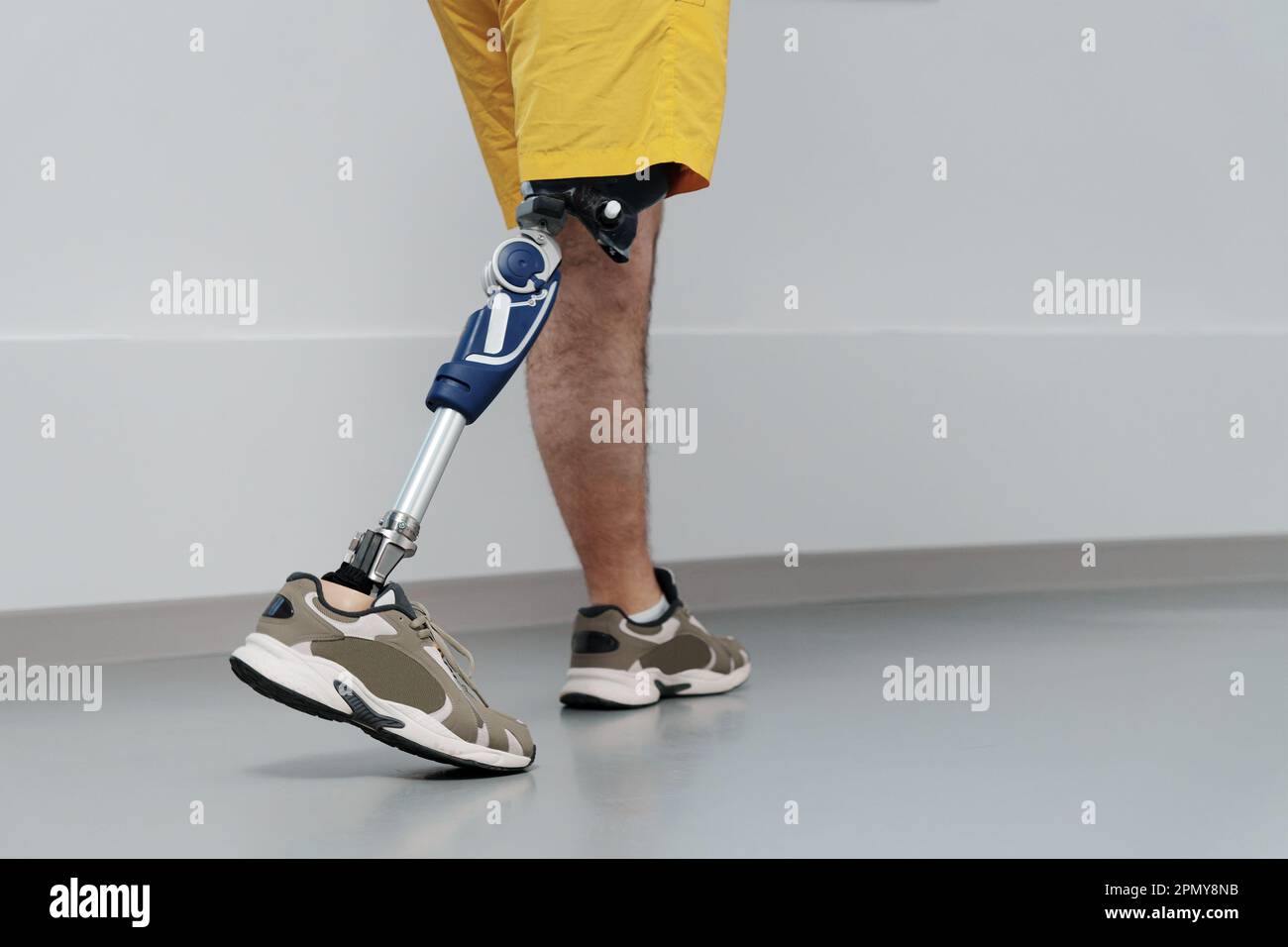 Unrecognisable male in yellow coloured shorts wearing prosthetic leg ...