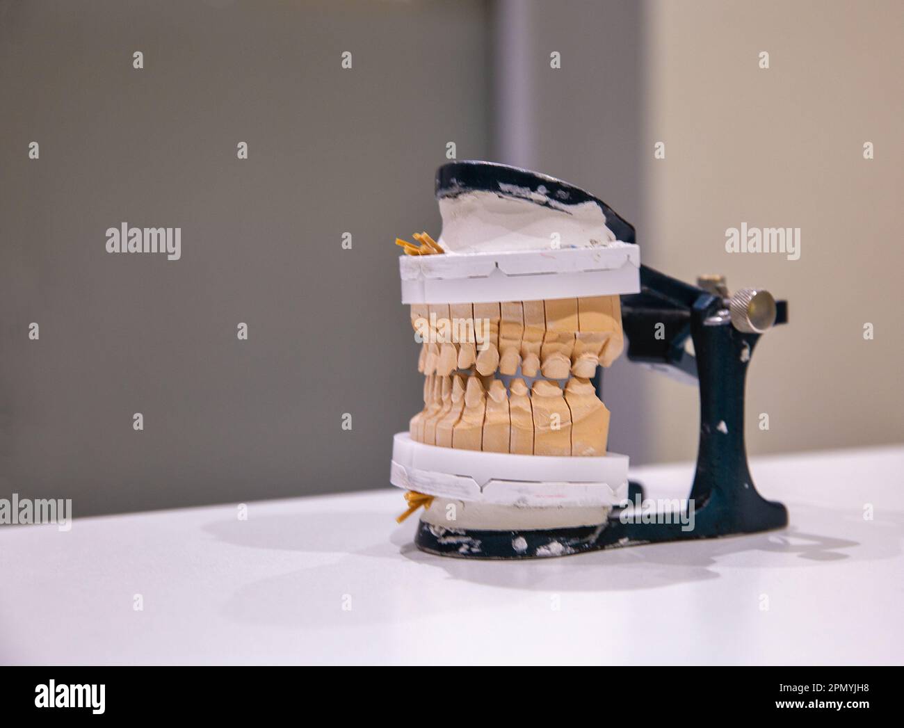 Manufacturing model of a human permanent ceramic-metal dental ...