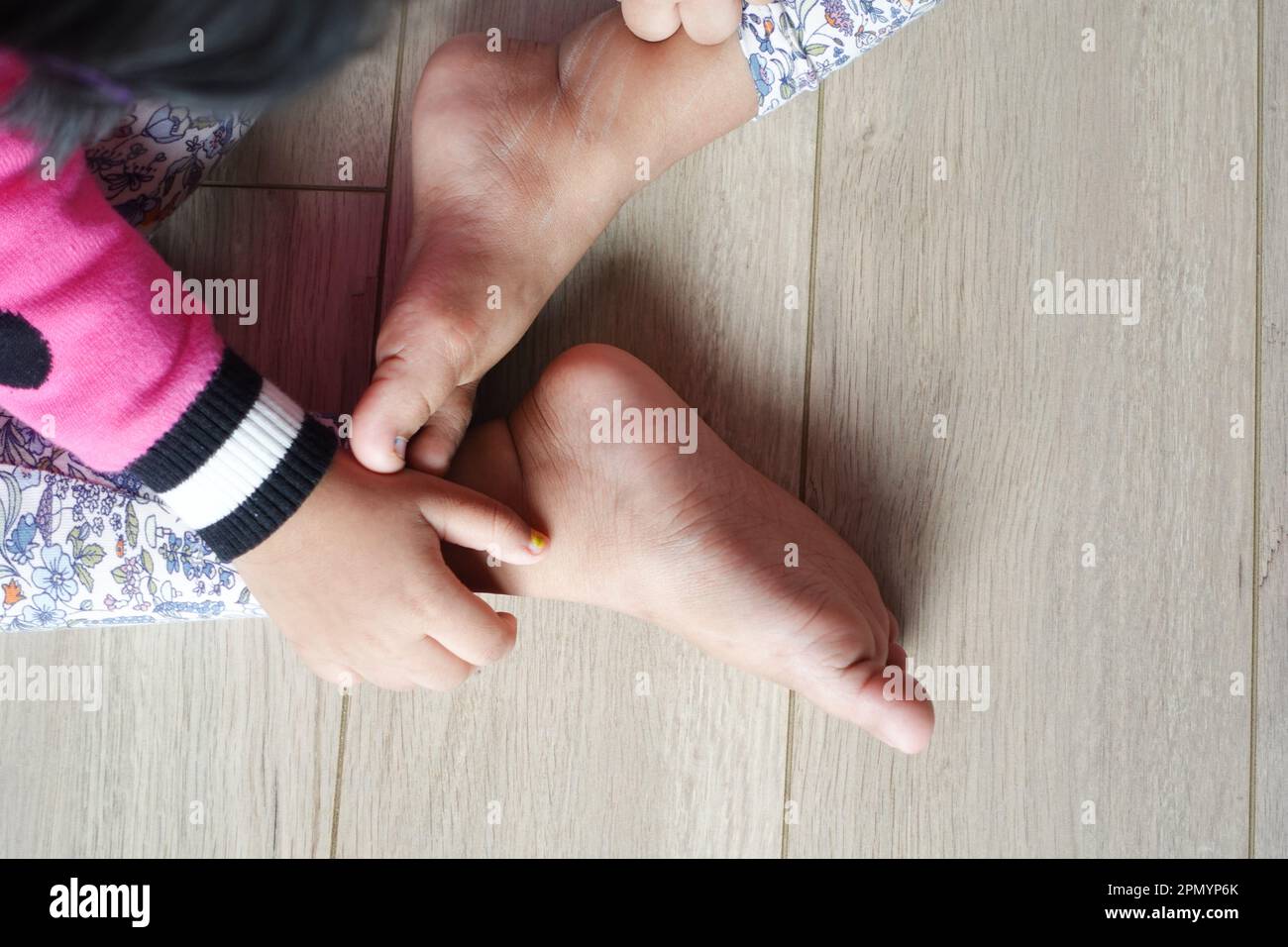 Girl itching arm hi-res stock photography and images - Alamy