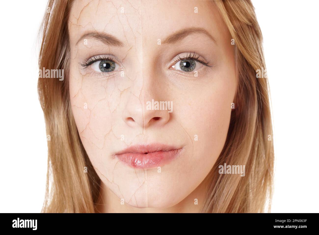 skin rejuvenation concept. young woman with dry skin texture on half of ...