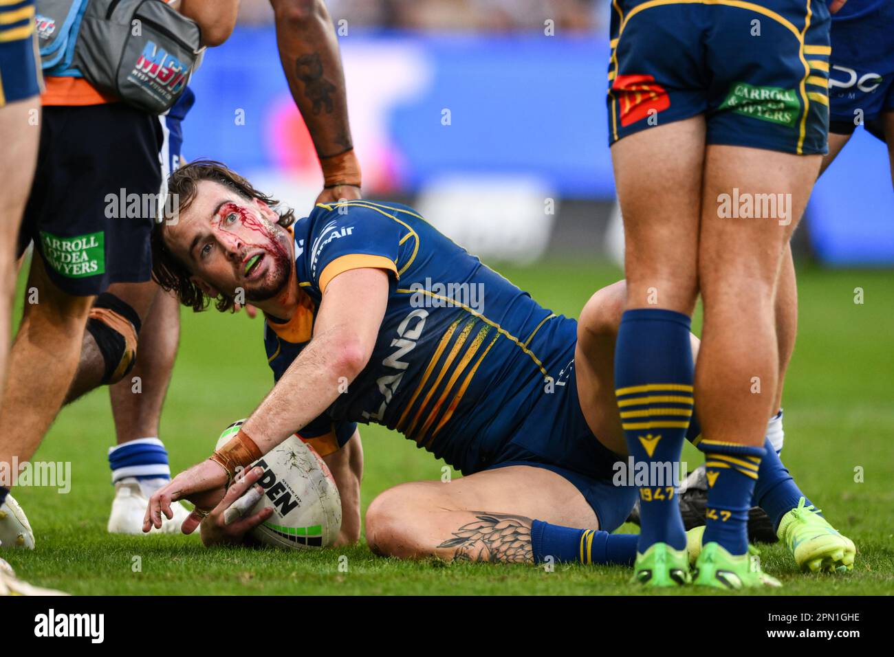 Clinton Gutherson of the Eels with blood on his face during the NRL ...
