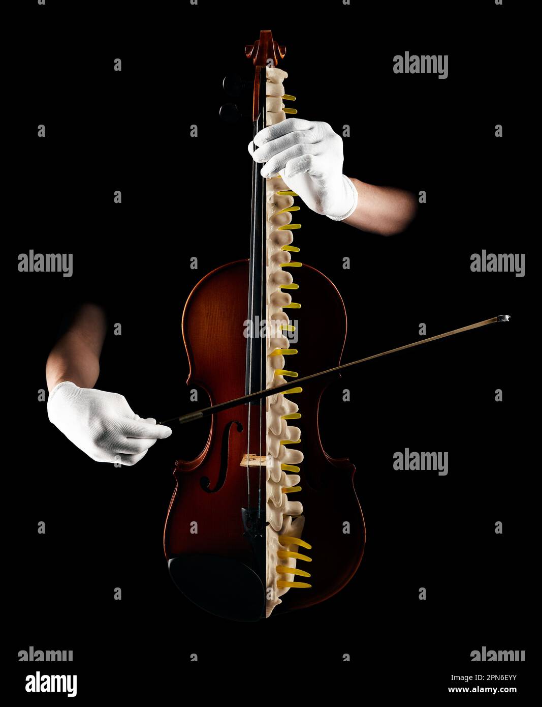 Spinal curvature hi-res stock photography and images - Alamy