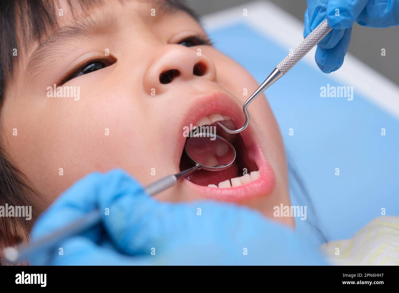 Close-up in the oral cavity of a healthy child with beautiful white ...