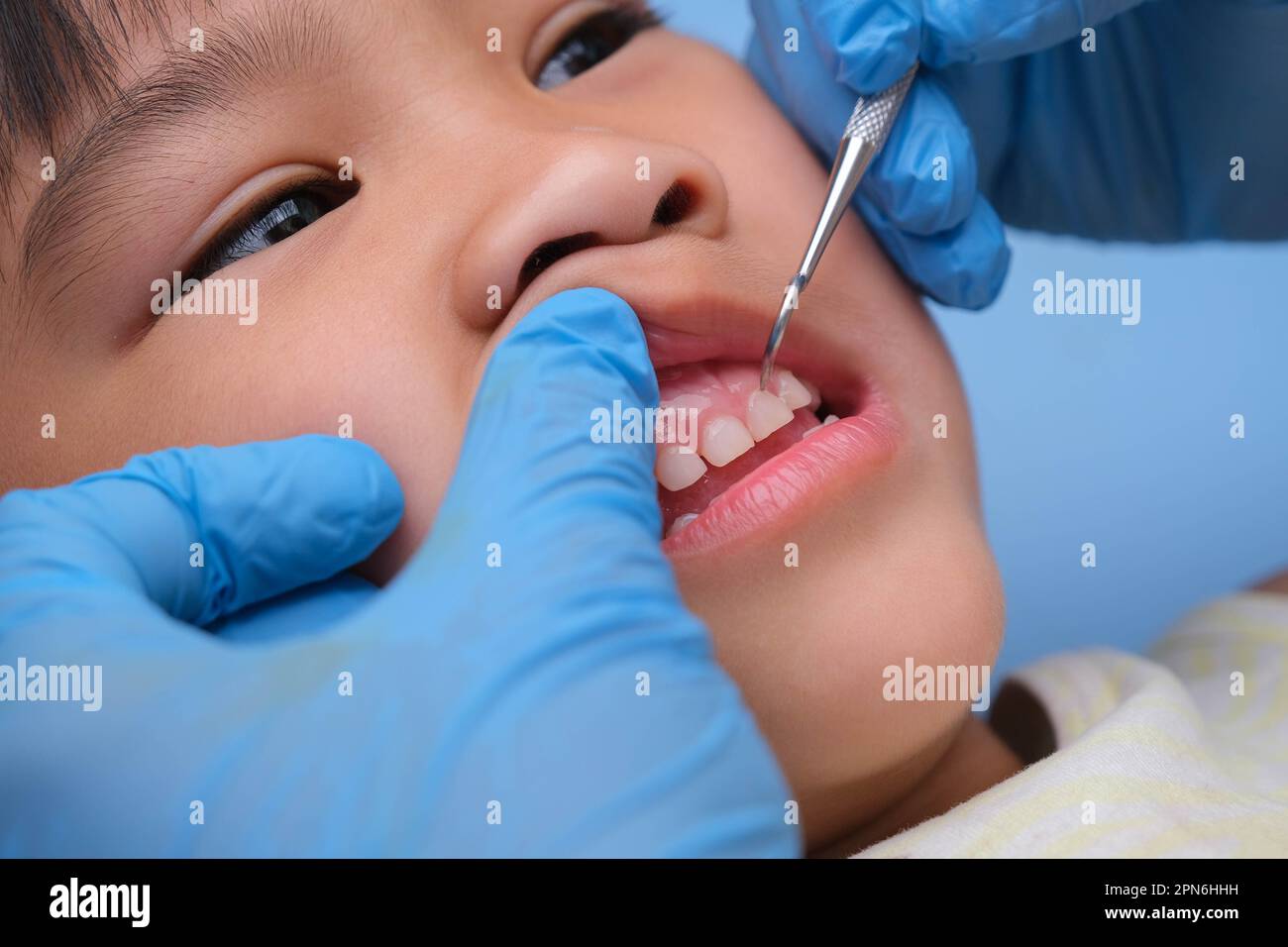 Close-up in the oral cavity of a healthy child with beautiful white ...