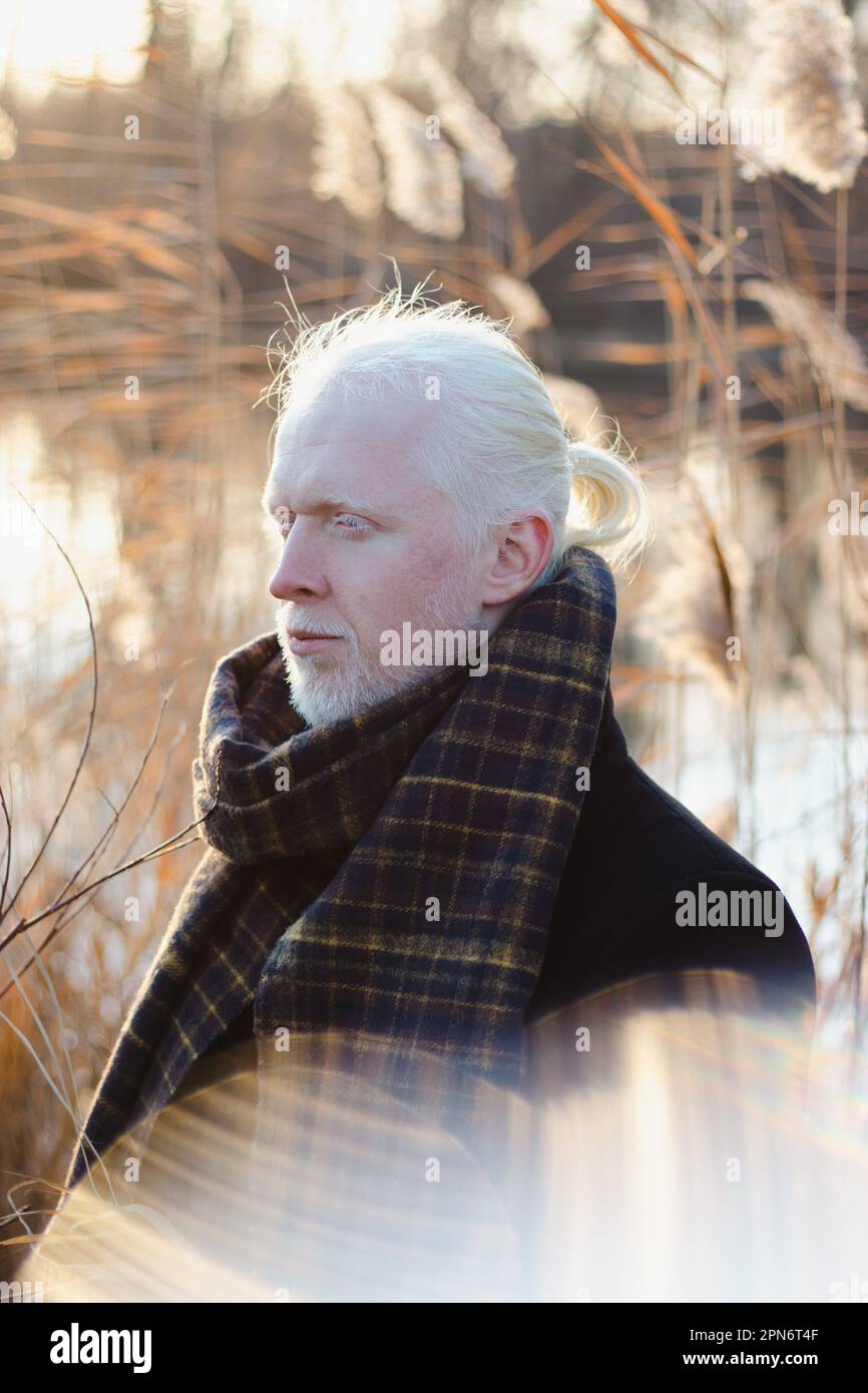 Portraits of an albino man with long hair. Autumn Stock Photo - Alamy